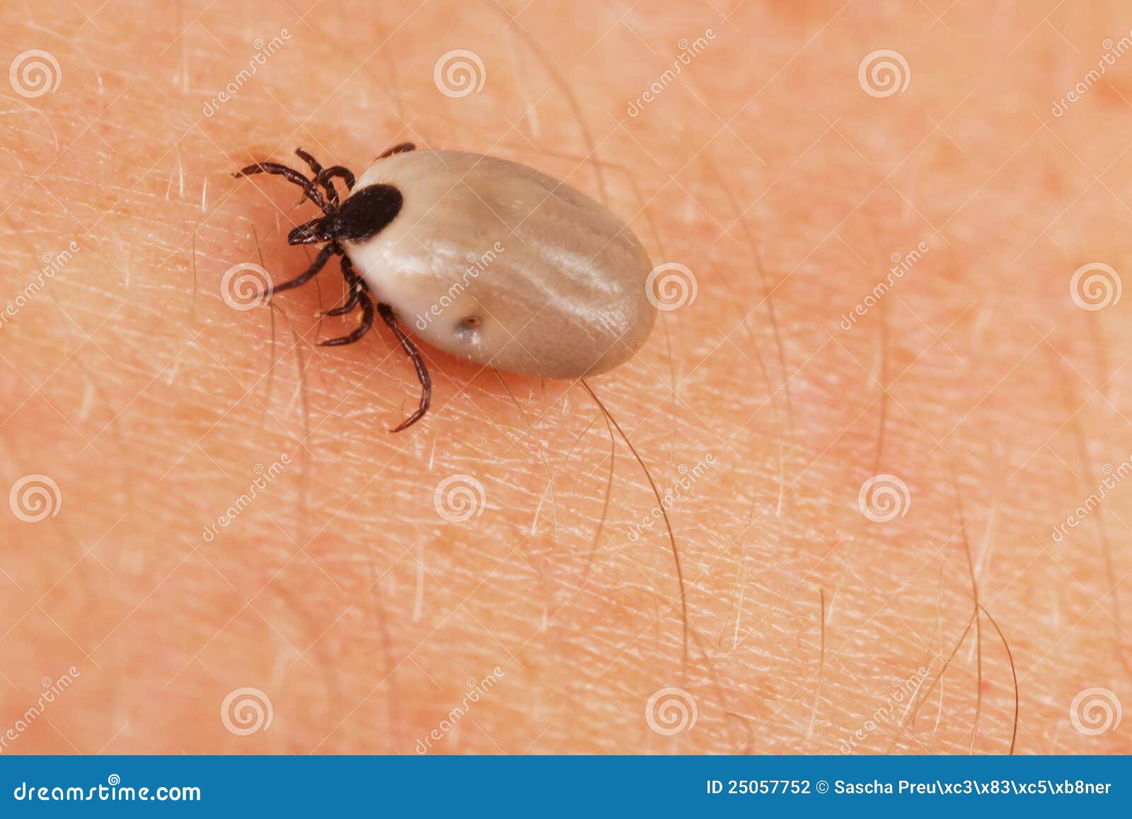 Tick On Human Hand. Ixodes Ricinus. Parasitic Mite. Dangerous Insect ...