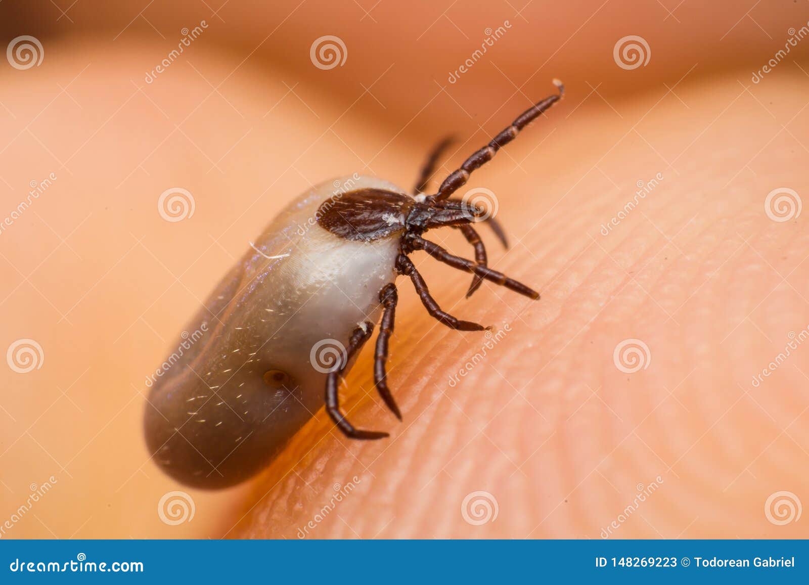 Tick on the Human Skin Surface Stock Image - Image of romania, fever ...