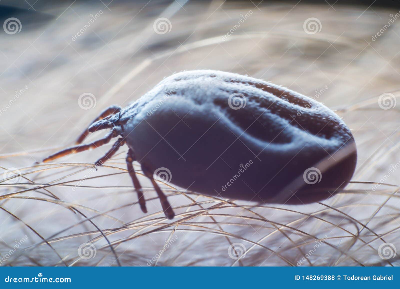 Tick on the Human Skin Surface Stock Photo - Image of fever, infection ...