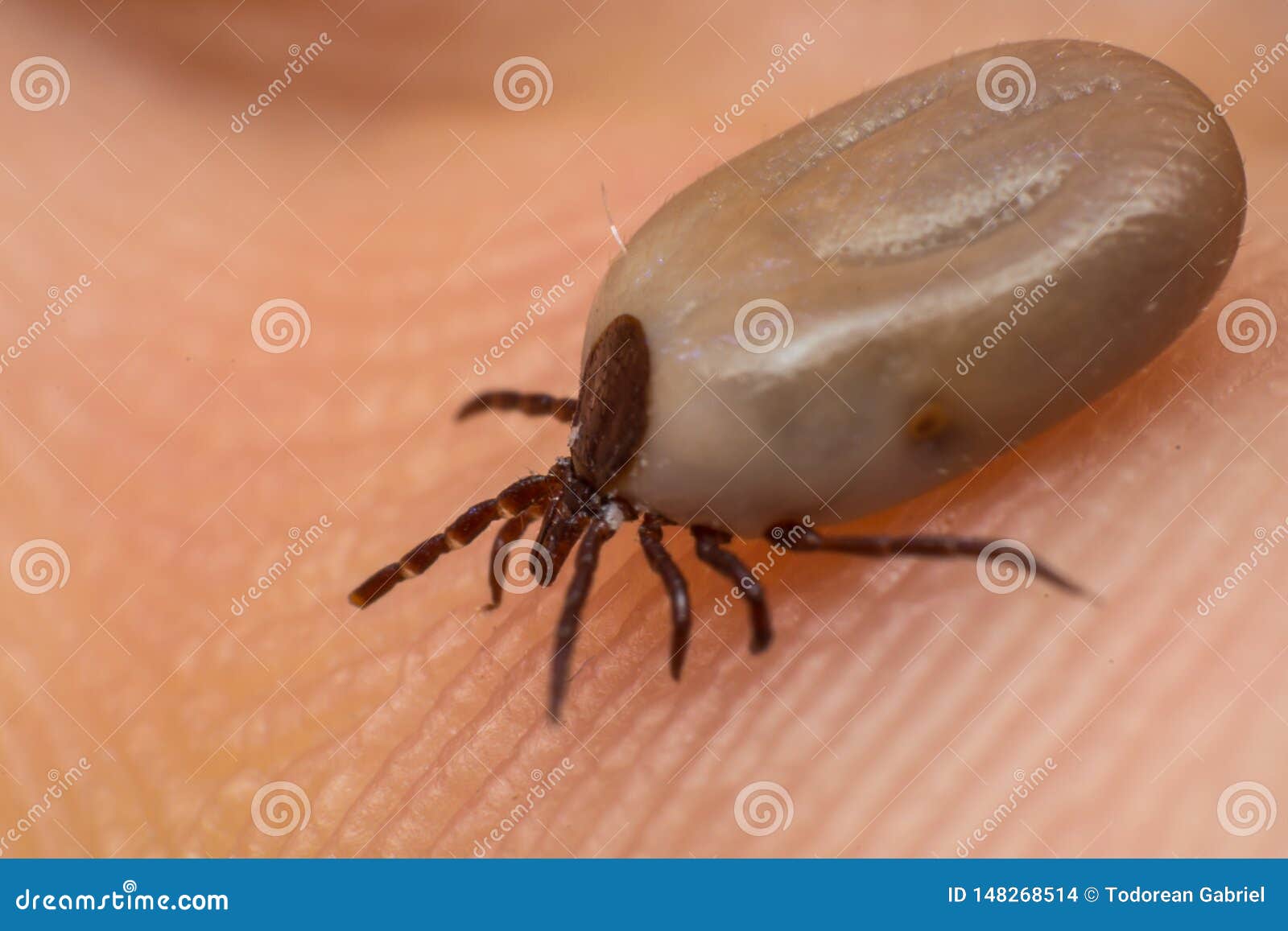 Tick on the Human Skin Surface Stock Photo - Image of disease, ixodes ...