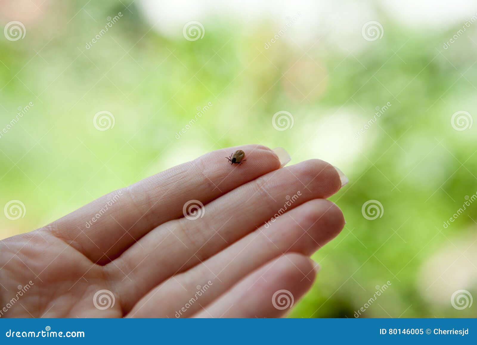Tick on humans finger stock image. Image of blood, bite - 80146005