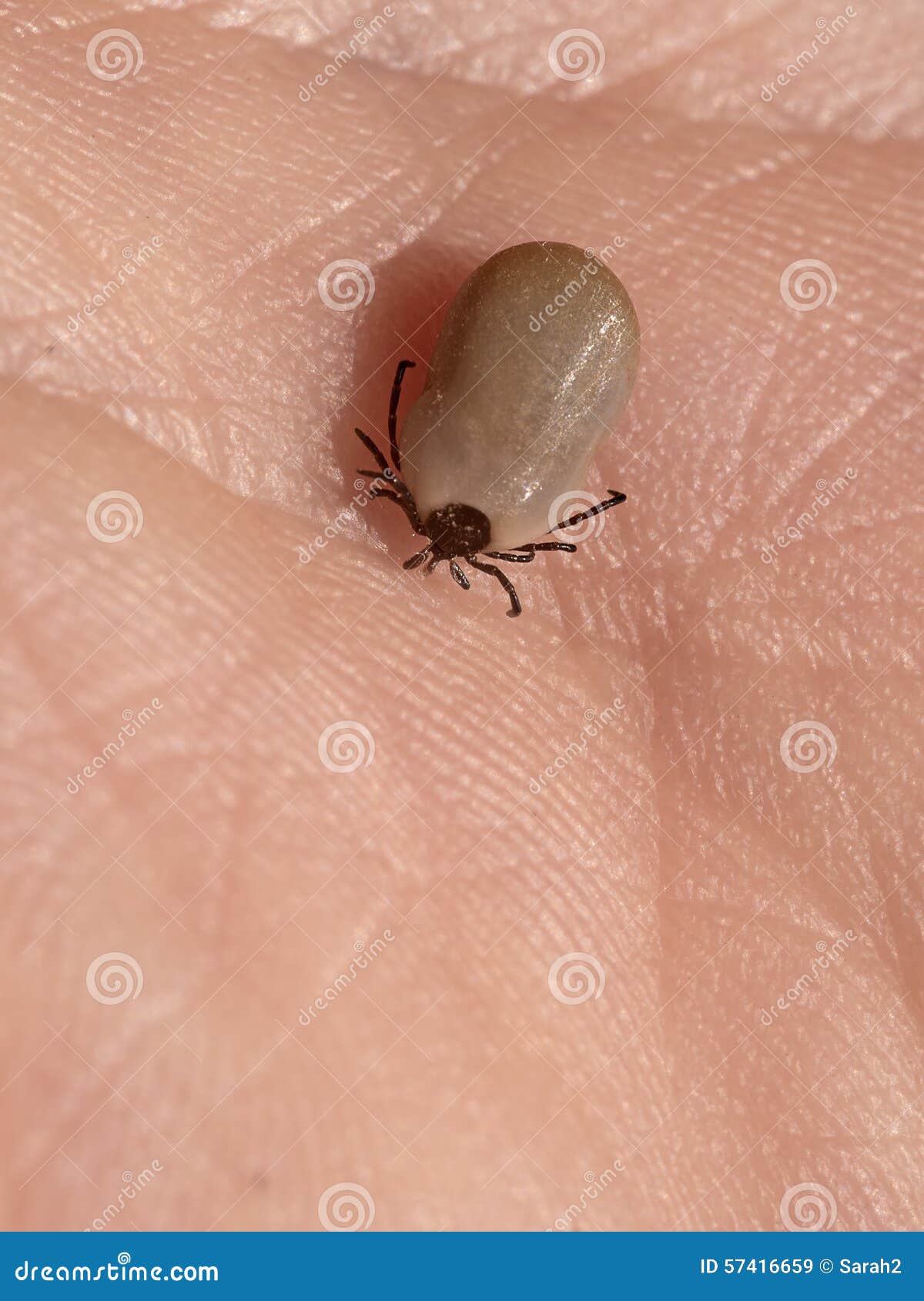 Engorged Cat Tick Over White, Macro Royalty-Free Stock Photography ...