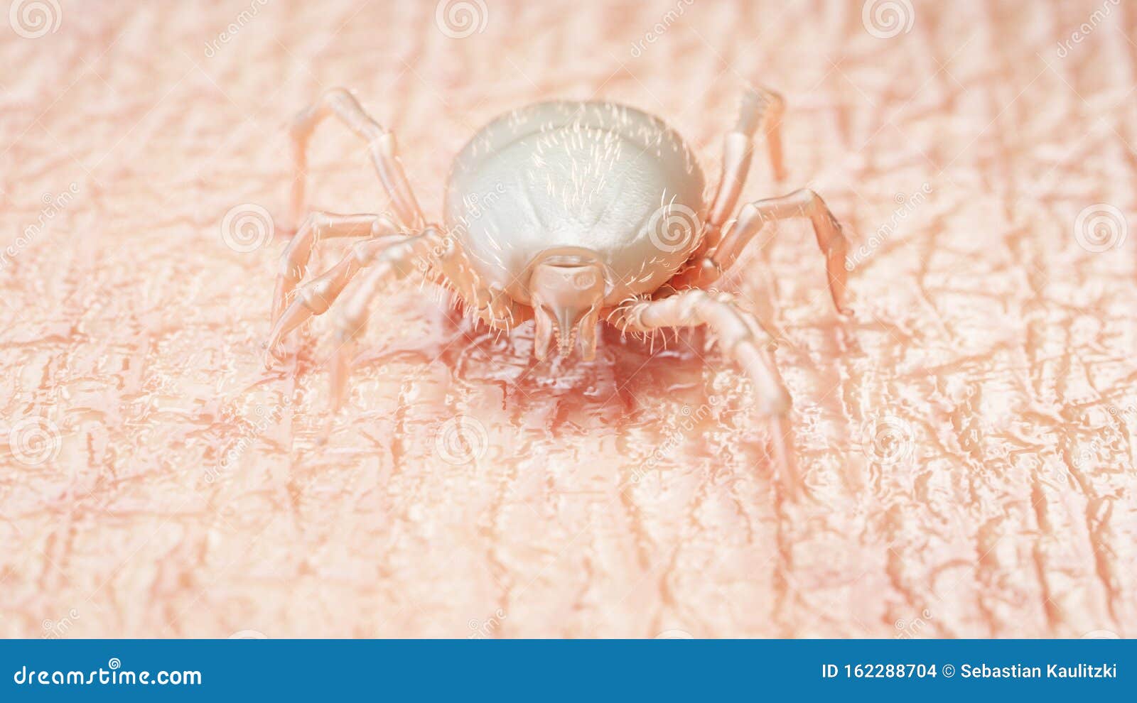 A tick larva stock illustration. Illustration of borreliosis - 162288704