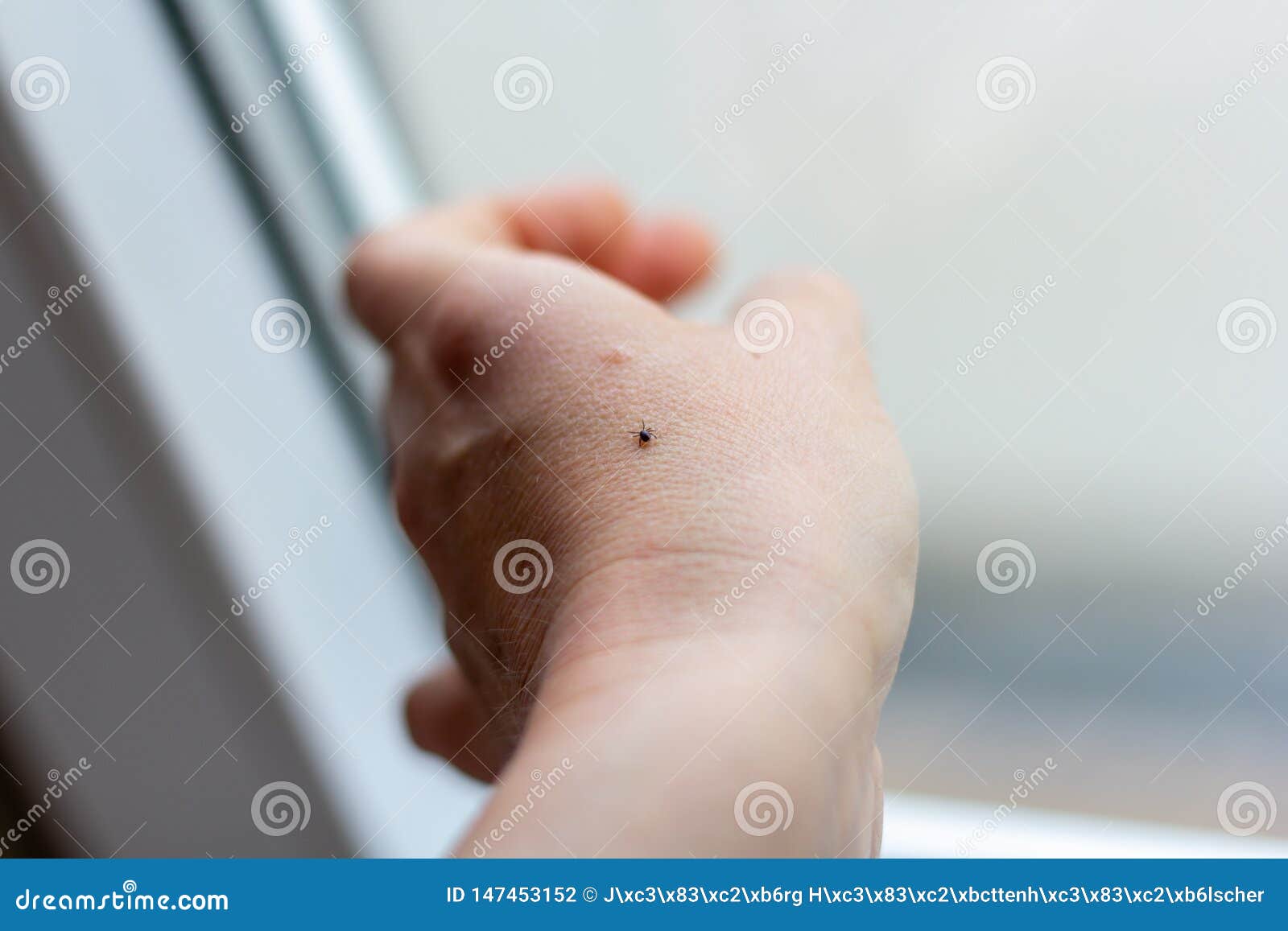 A Tick Runs Around on a Hand Stock Photo - Image of blood, borreliosis ...