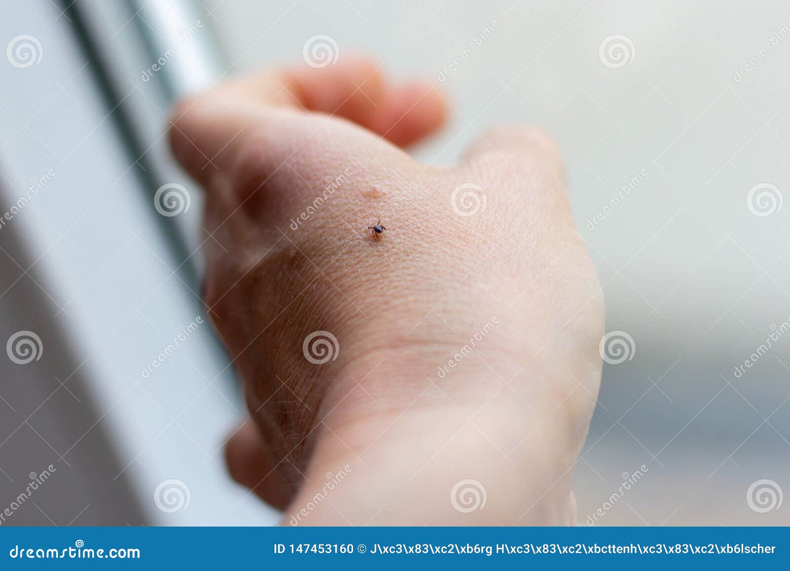 A Tick Runs Around on a Hand Stock Photo - Image of bite, arachnid ...