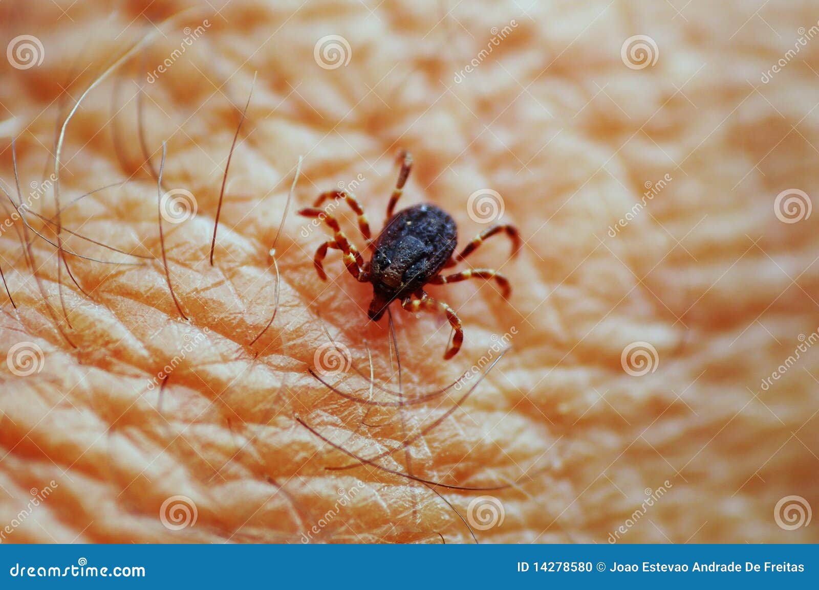Tick on skin stock photo. Image of creepy, summer, terrorist - 14278580