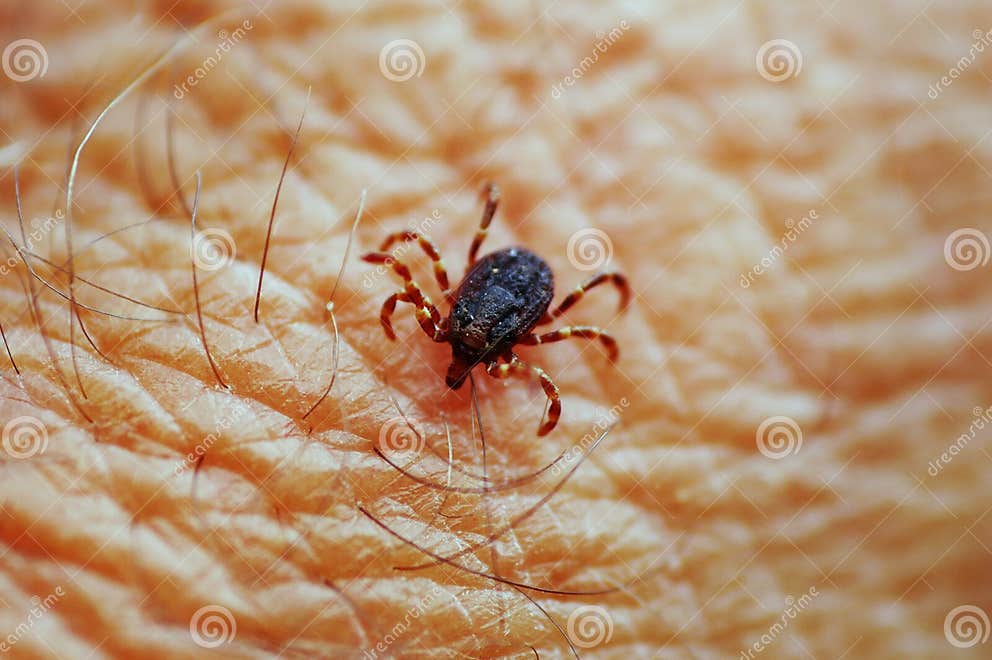 Tick on skin stock photo. Image of creepy, summer, terrorist - 14278580