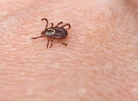 Tick on Skin stock photo. Image of parasite, bloodsucking - 14341986