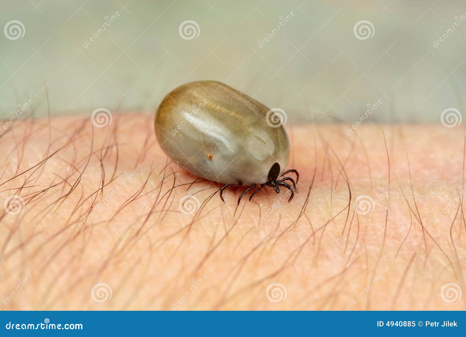 Tick on the skin stock image. Image of sickness, bite - 4940885