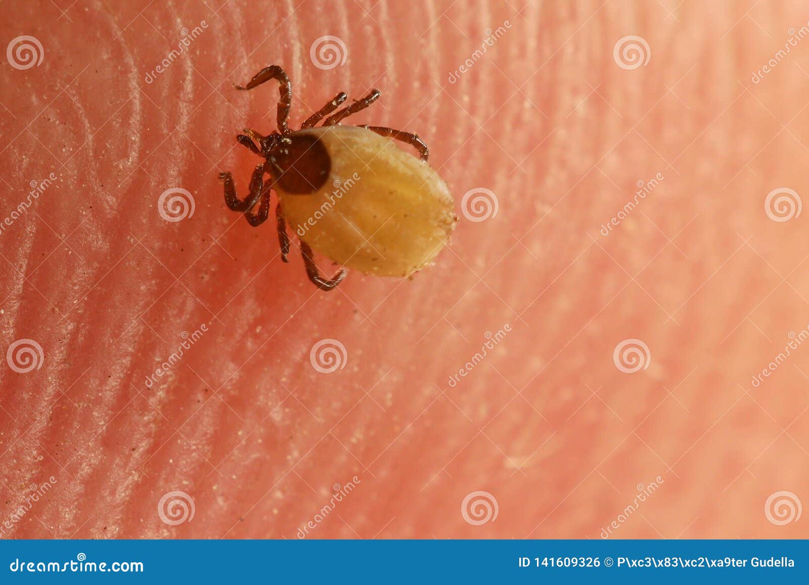 Tick on skin stock photo. Image of disease, crawl, animal - 141609326