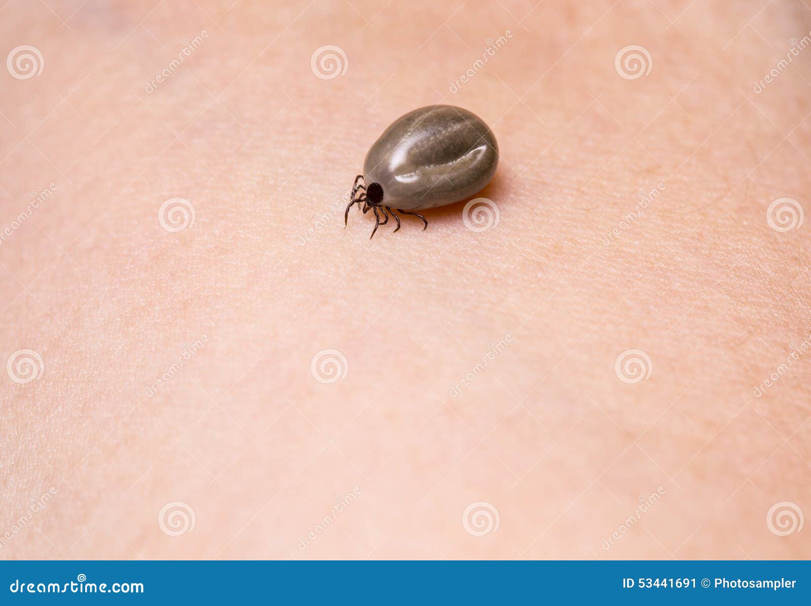 Tick on a skin stock image. Image of people, human, infection - 53441691