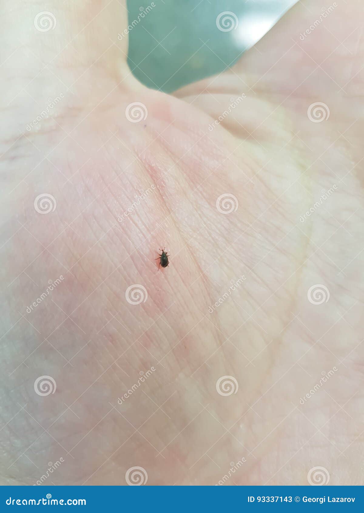 Tick on skin stock image. Image of human, insect, skin - 93337143