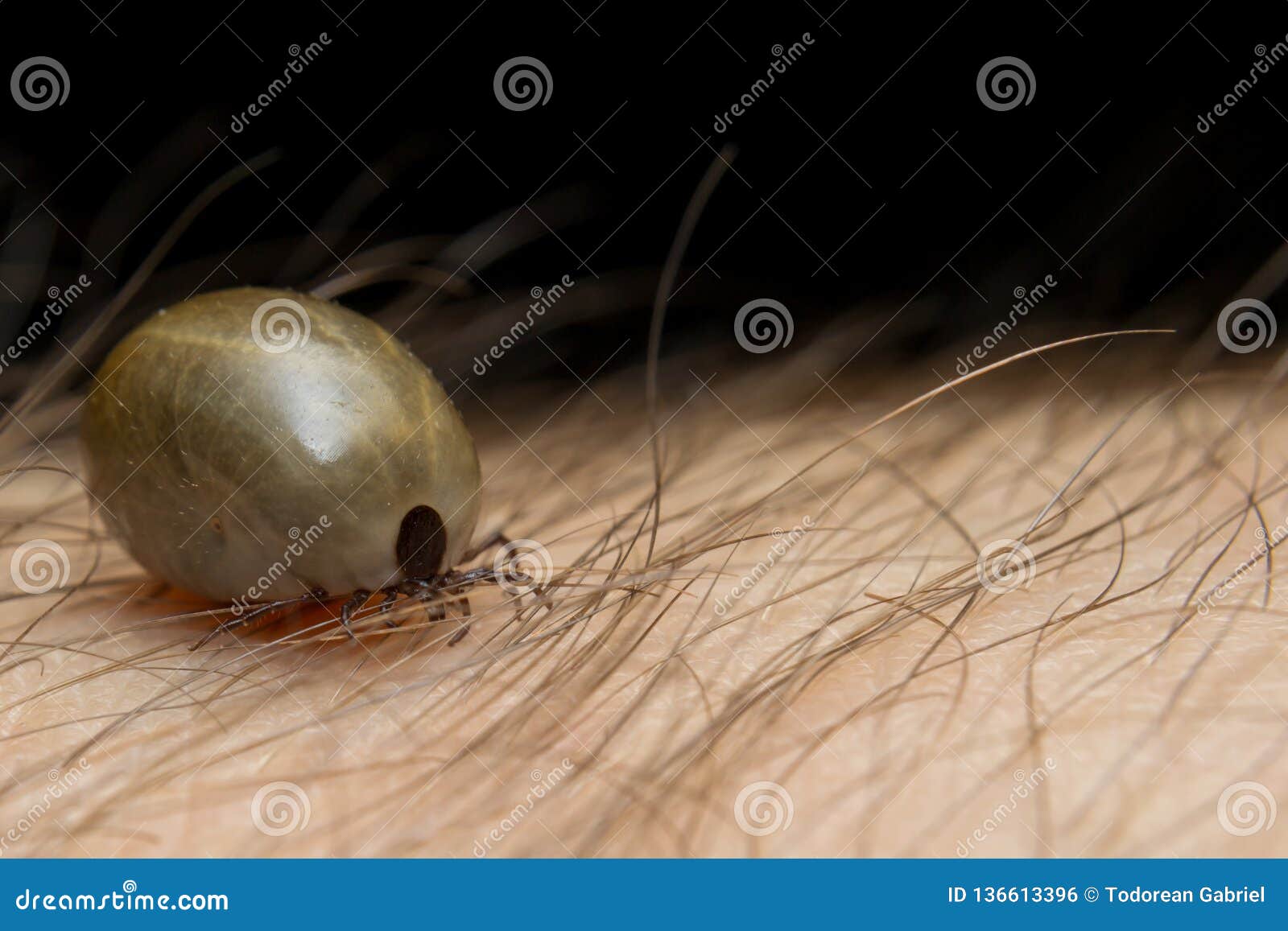 Tick on skin surface stock photo. Image of adult, tick - 136613396