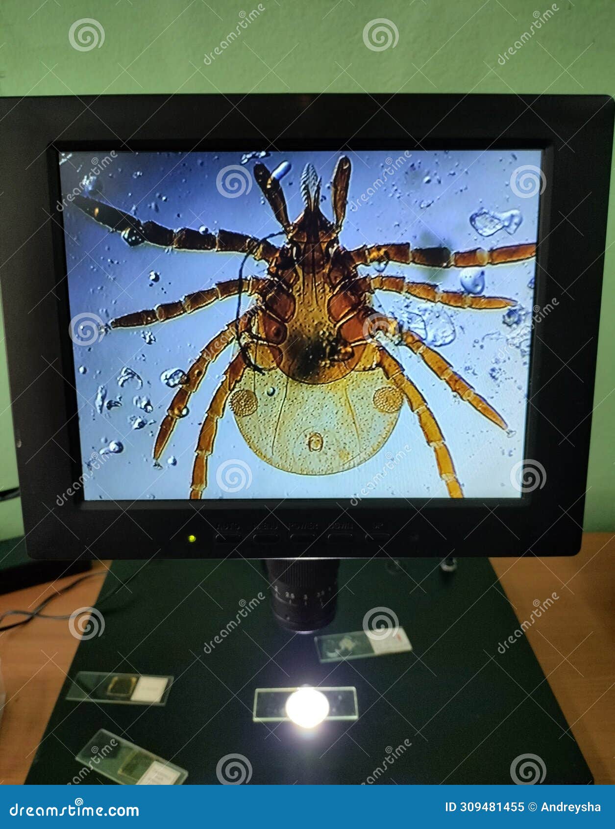 Microscope - Tick (Rhipicephalus Sanguineus) Stock Photo ...