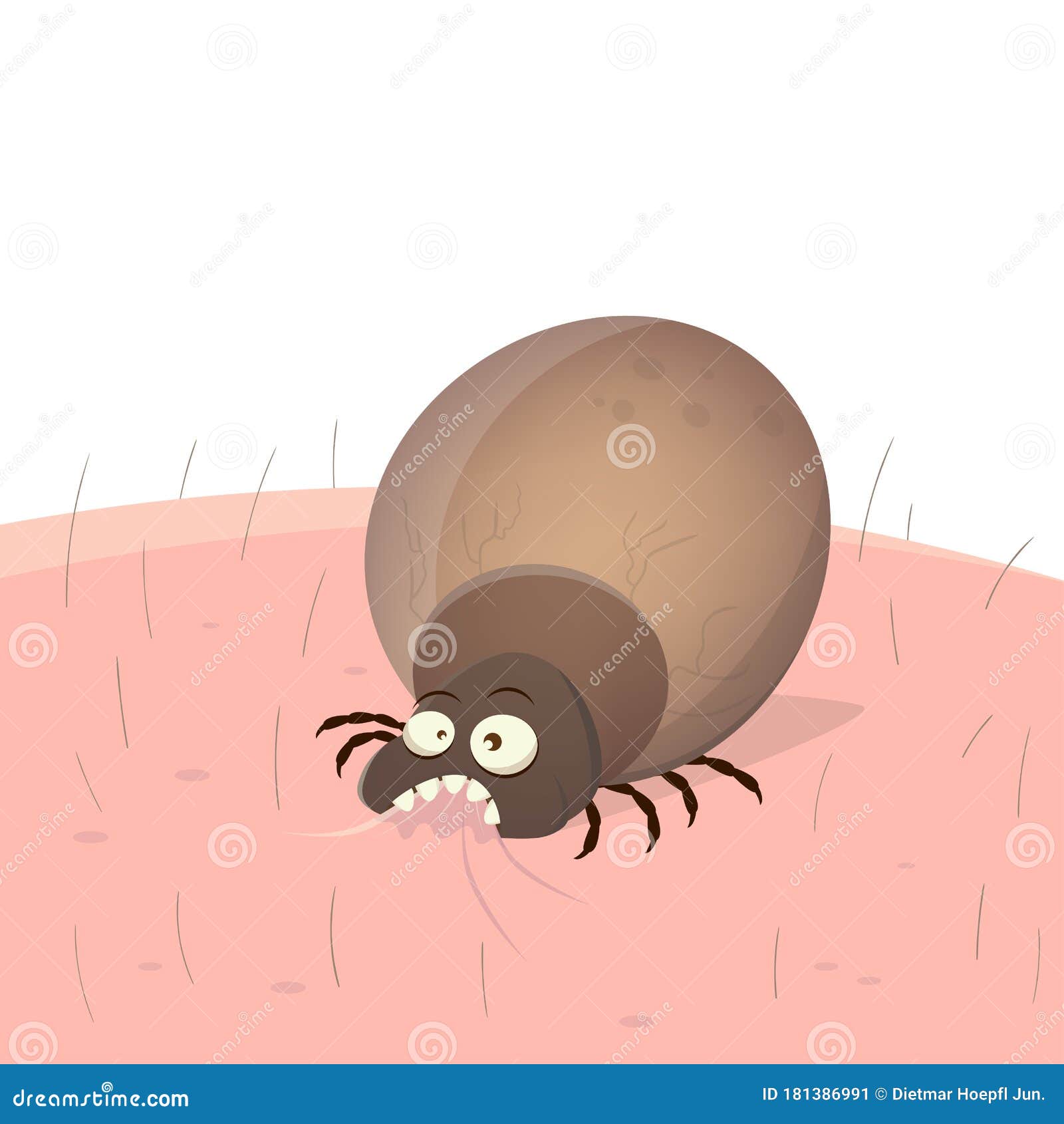 Funny Vector Illustration of a Cartoon Tick on Human Skin Stock Vector ...
