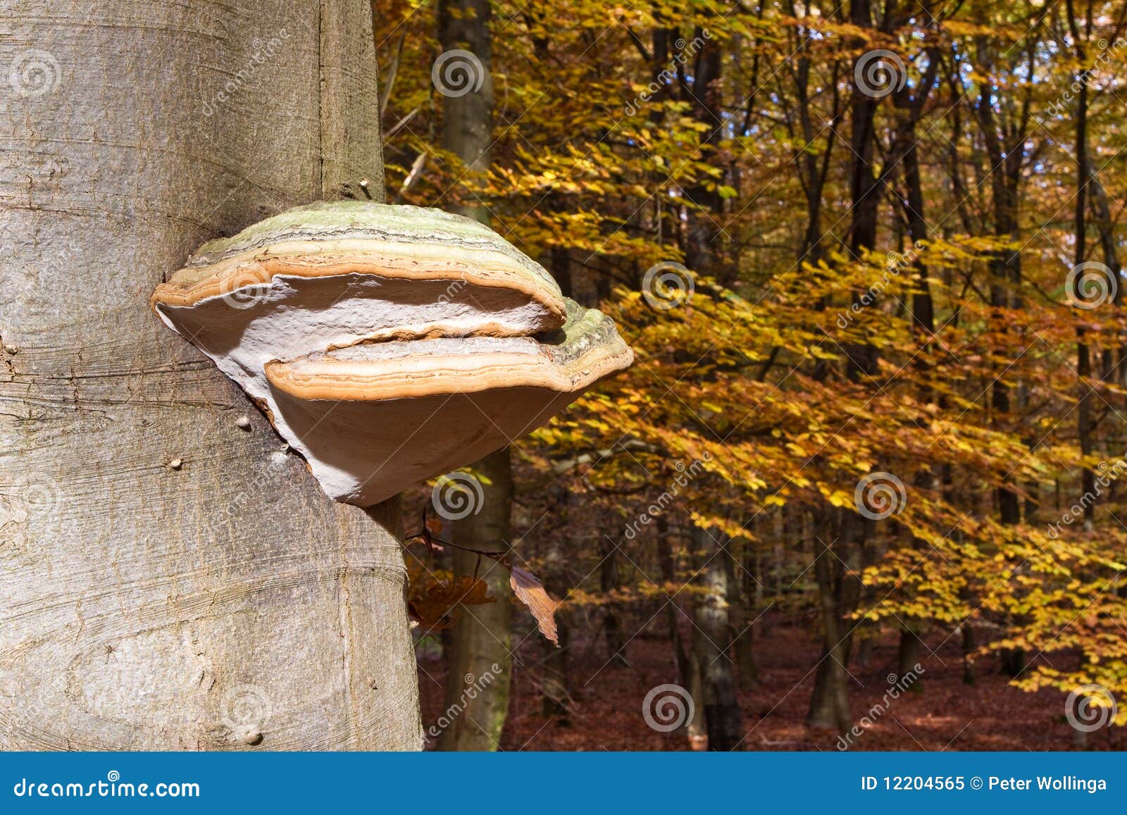 Fungus Mushroom Between Toenail. Smelly Feet Stock Photo ...