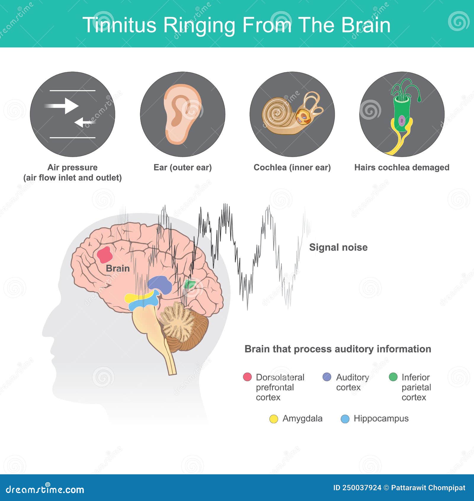 Tinnitus Ringing from the Brain, is the Term for a Buzzing Noise in ... Tinnitus Ringing from the Brain, is the Term for a Buzzing Noise in ...