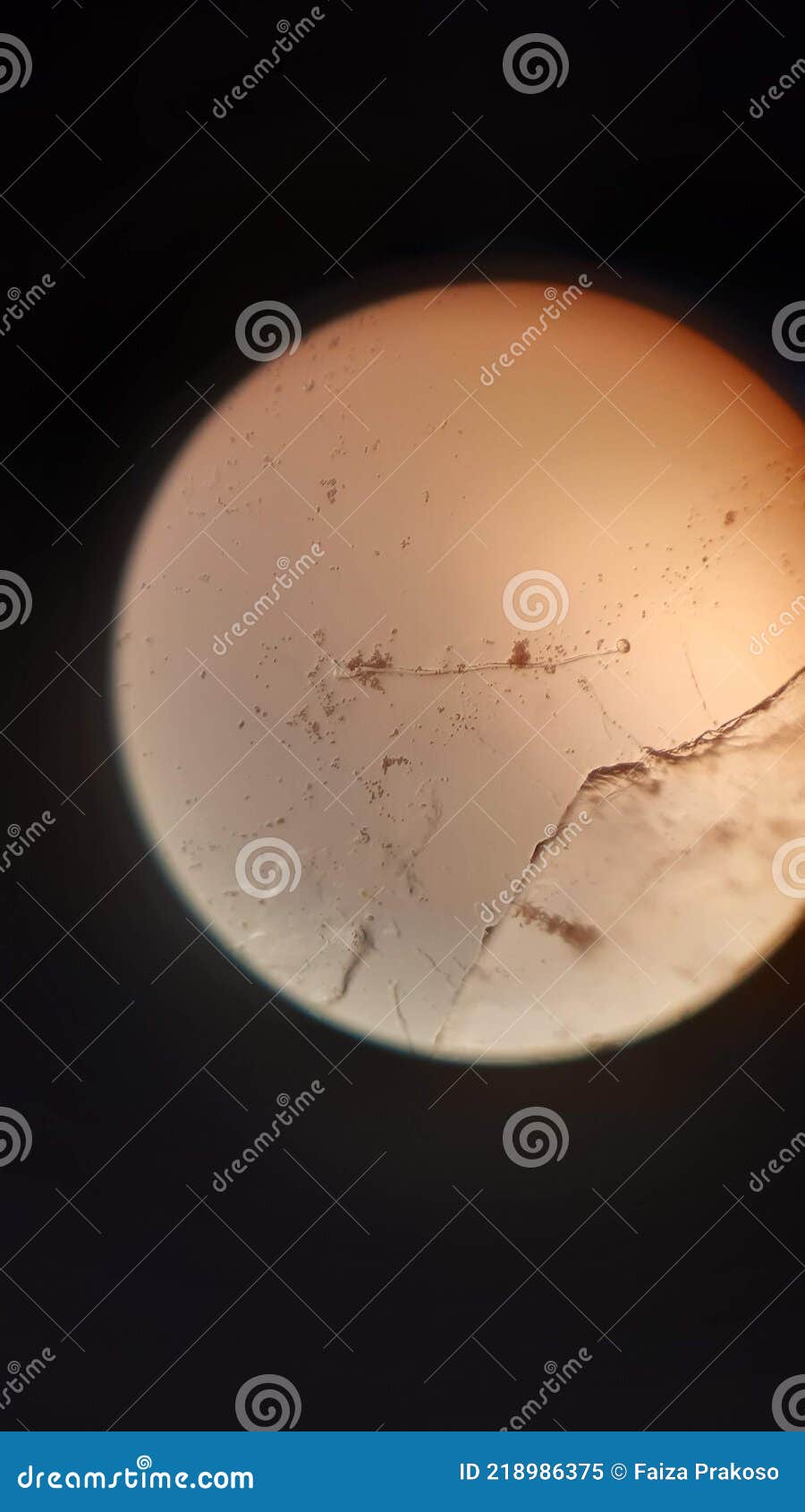 Tiny Bacteria Visible through a Microscope Stock Image - Image of ...
