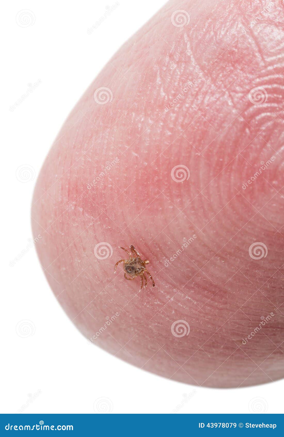 Tick Nymph Size Comparison Next To Paper Clip Stock Image ...