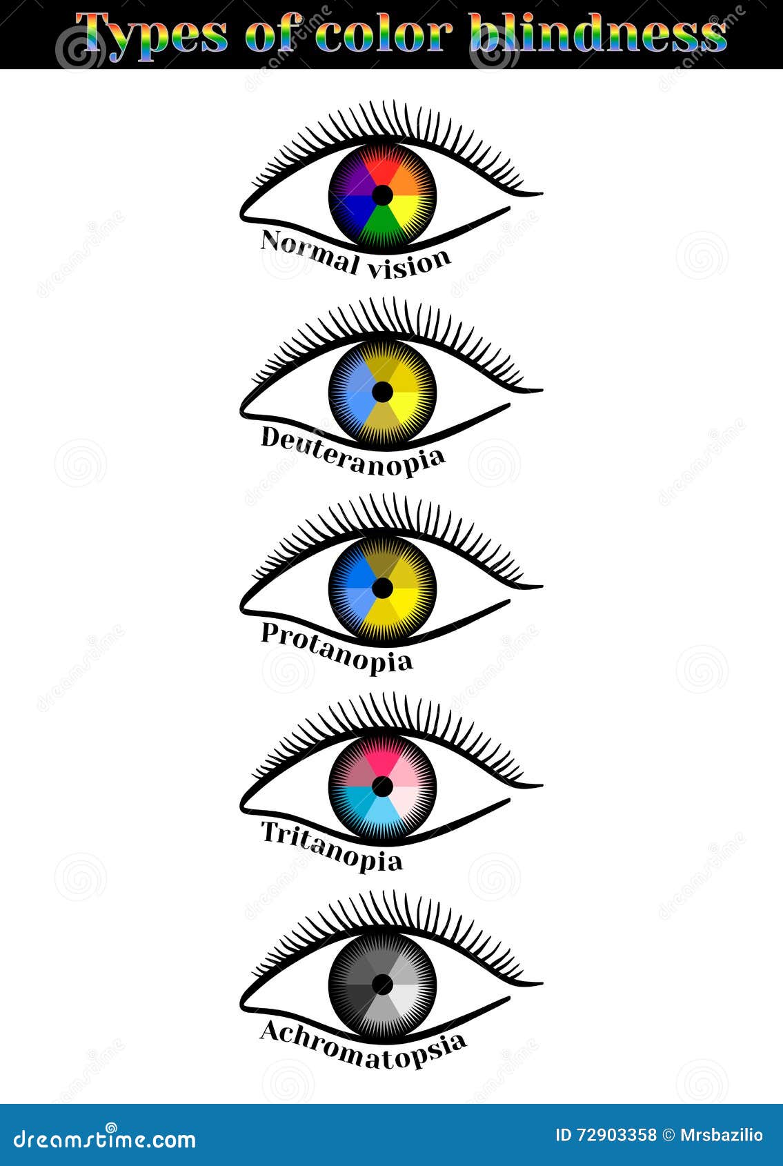 Tipos de cegueira de cor ilustração do vetor. Ilustração de limpar ...