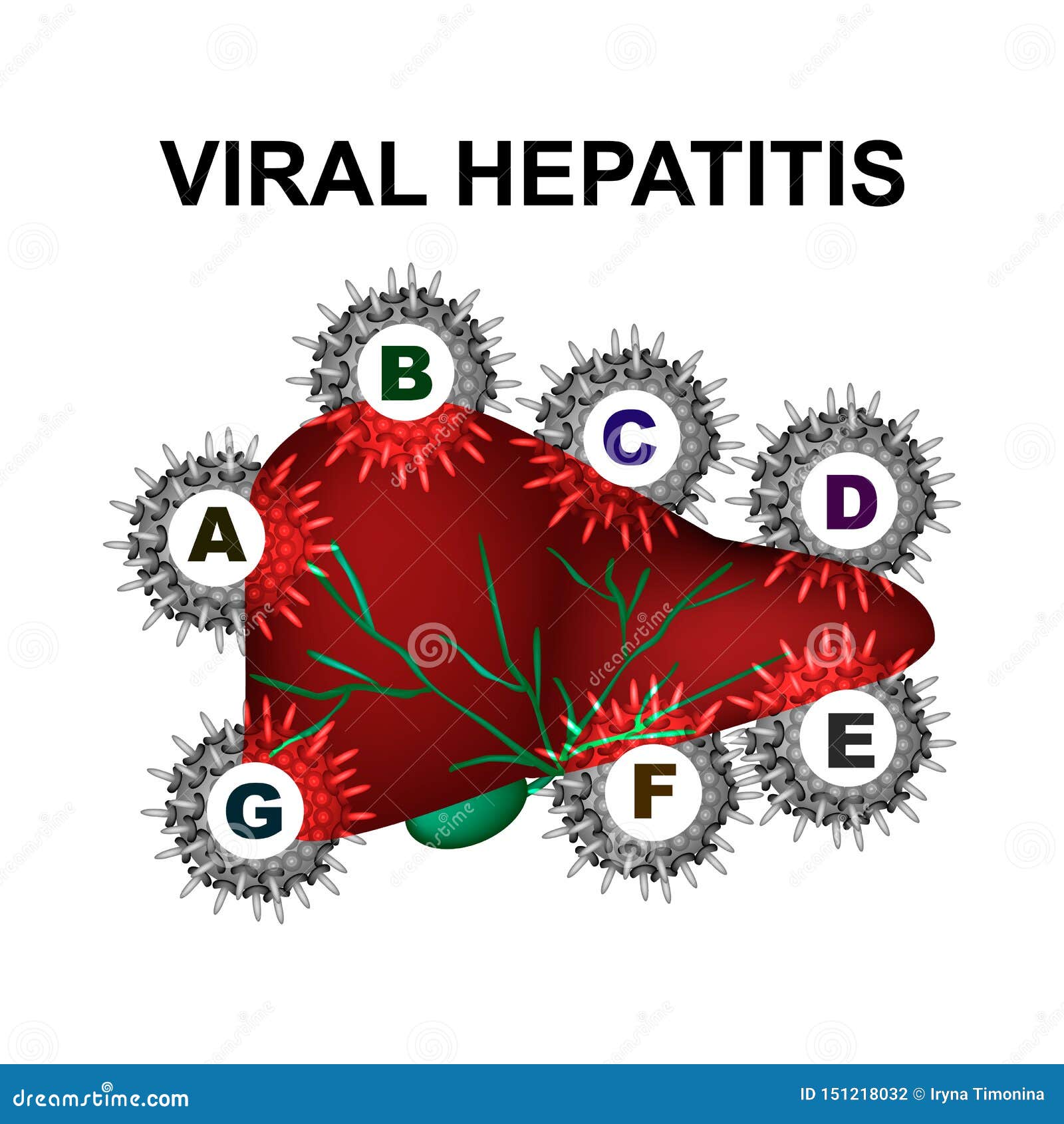 Tipos De Hepatite Viral Hepatite a, B, C, D, E, F, G Dia Da Hepatite Do ... Tipos De Hepatite Viral Hepatite a, B, C, D, E, F, G Dia Da Hepatite Do ...