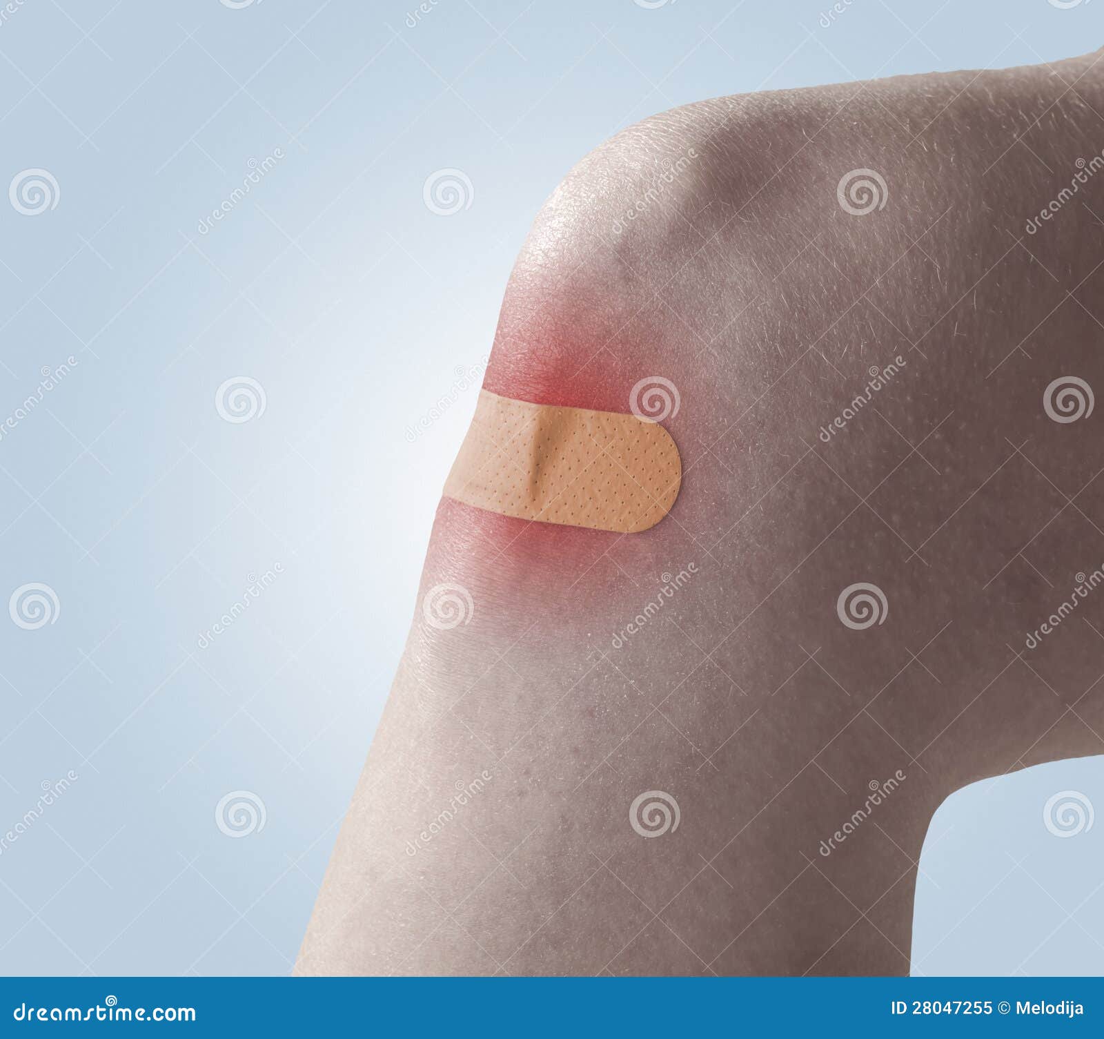 Tirita en rodilla imagen de archivo. Imagen de tratamiento - 28047255