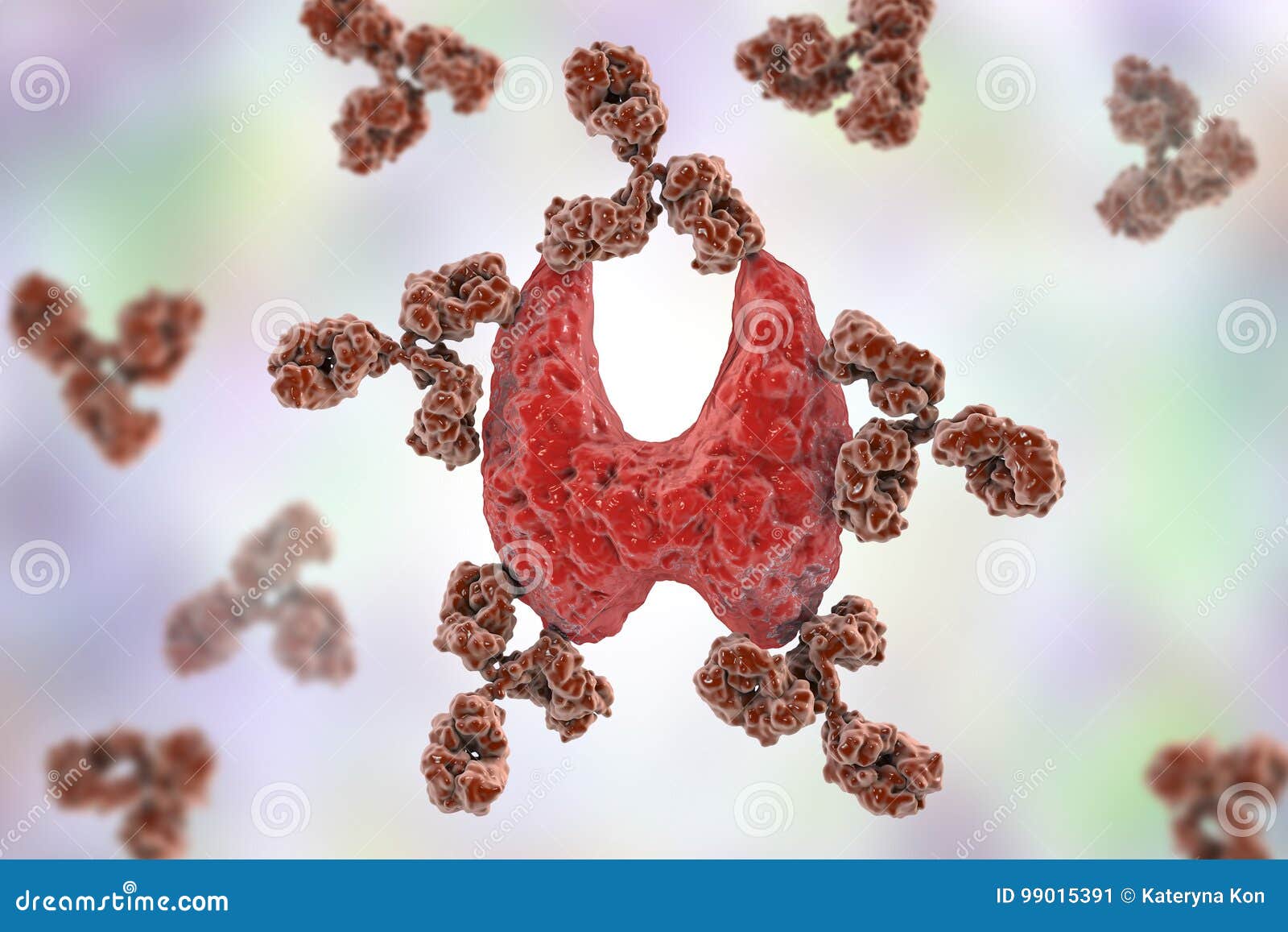 Tiroidite Autoimmune, Malattia Del ` S Di Hashimoto Illustrazione di ...