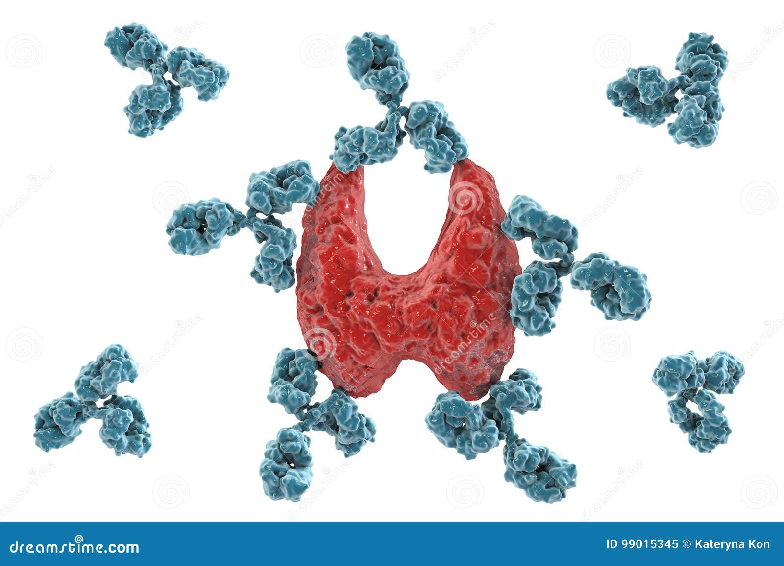 Hipotiroidismo Y Tiroiditis Autoinmune Atrófica – RXDBBU