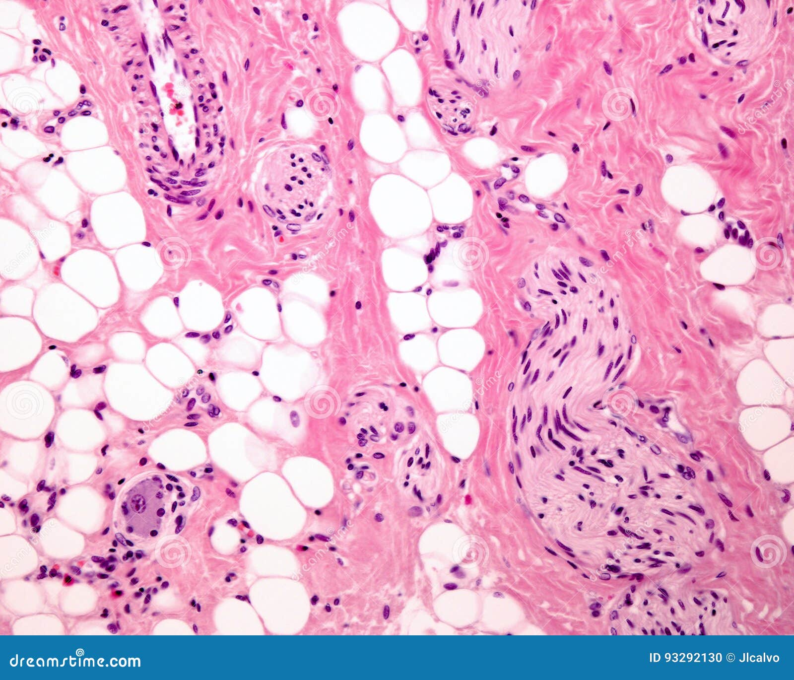 Tissu adipeux photo stock. Image du histologie, gouttelette - 93292130