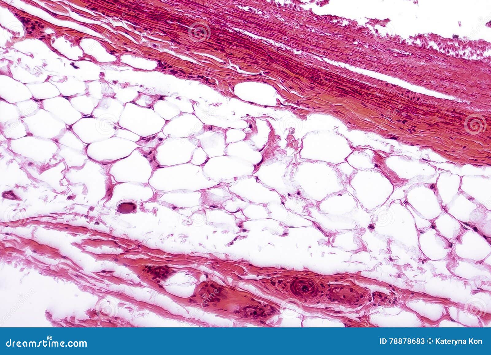 Tissu adipeux blanc image stock. Image du maladie, fermer - 78878683