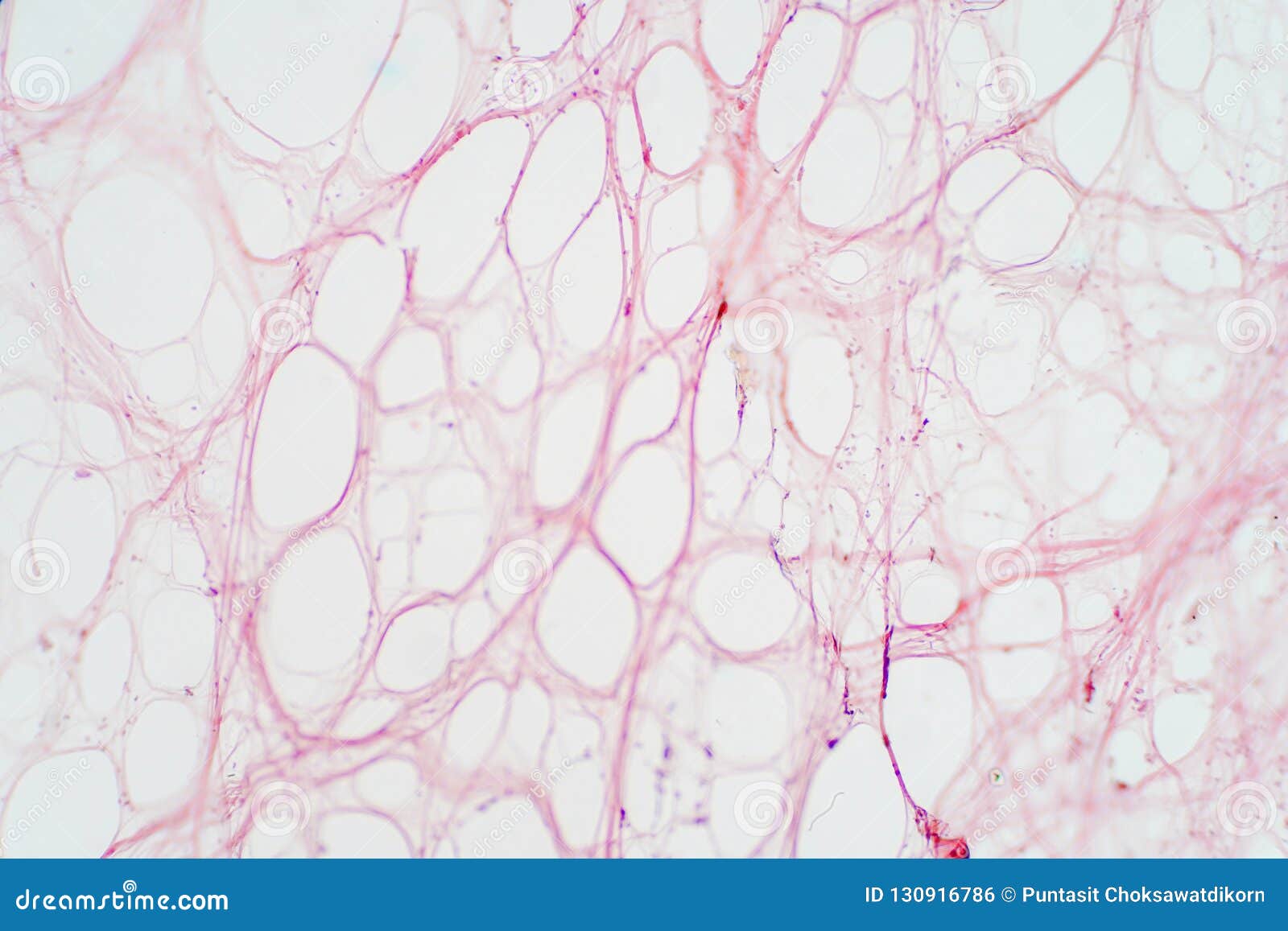 Tissu Conjonctif Areolar Sous La Vue De Microscope Photo stock - Image ...