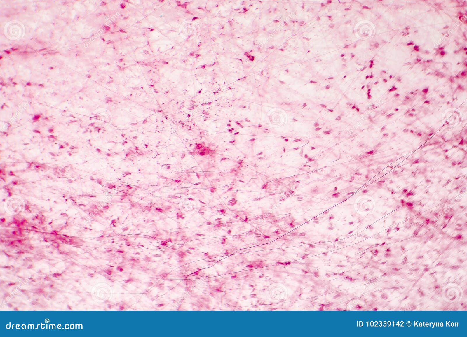 Tissu conjonctif lâche photo stock. Image du grossissement - 102339142