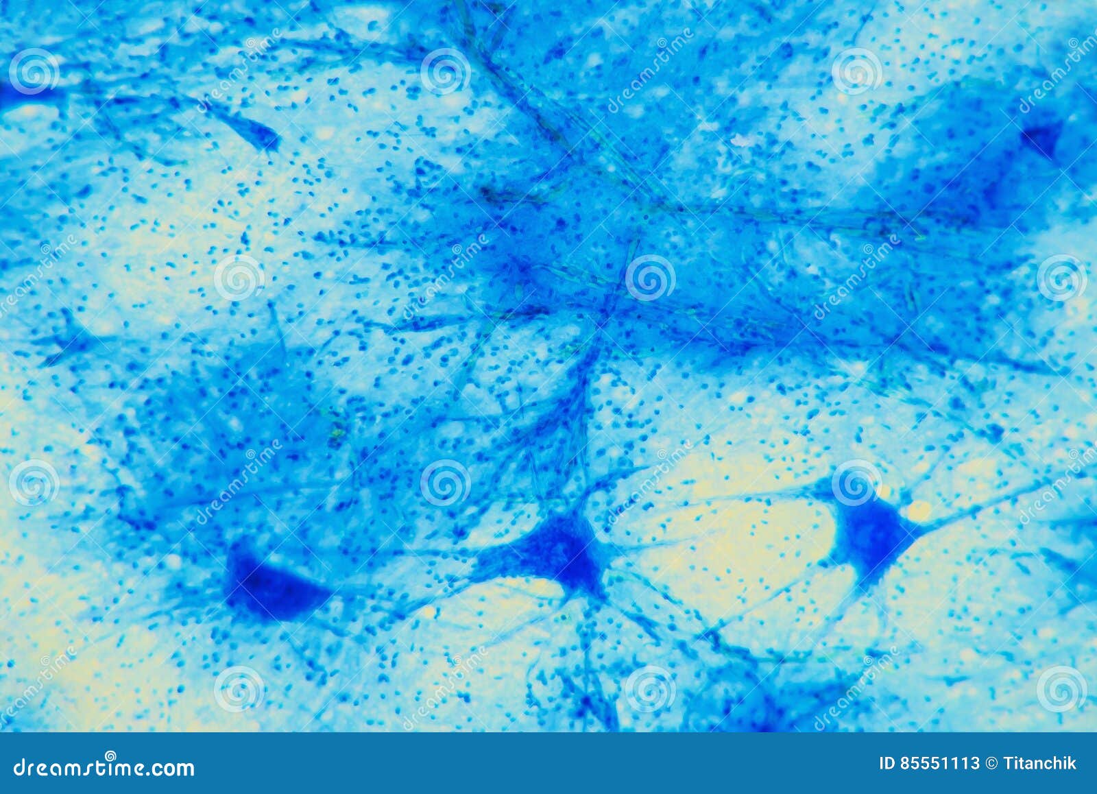 Tissu Microscopique De Neurone De Cellules Image stock - Image du ...