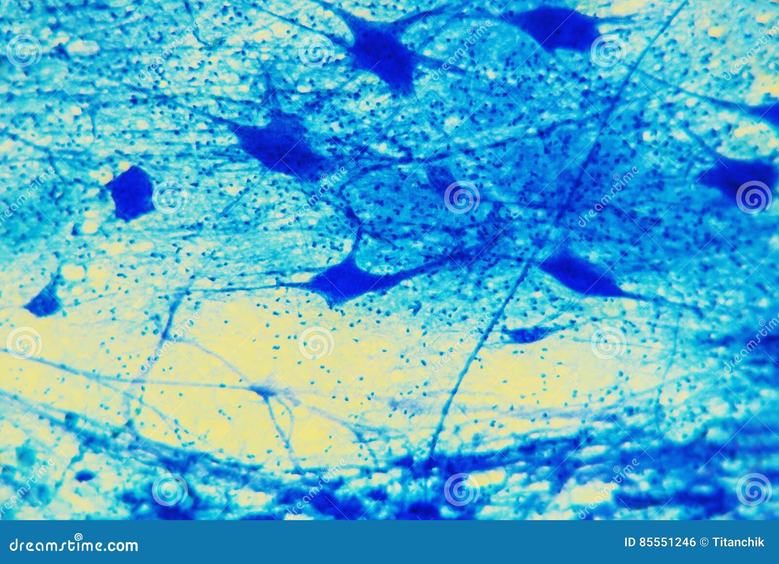 Tissu Microscopique De Neurone De Cellules Photo stock - Image du micro ...