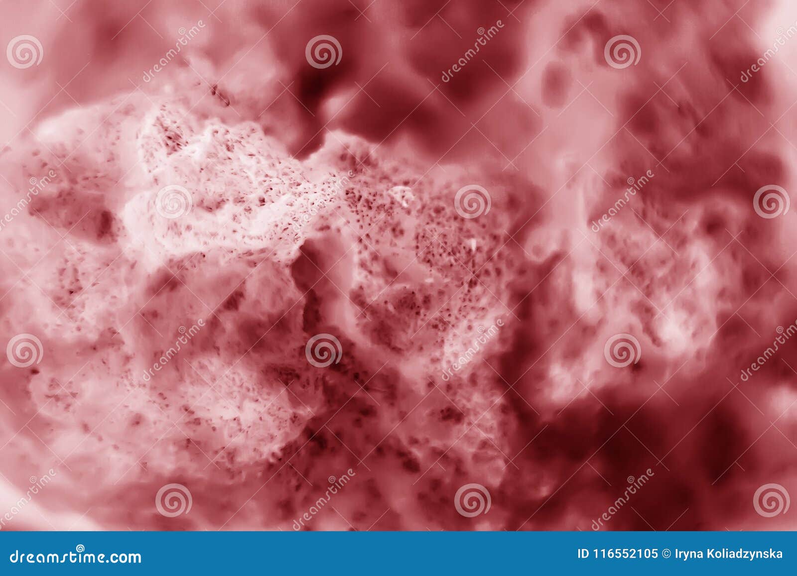 Tissue Affected By Cancer Cells Under A Microscope, Science. Medicines ...