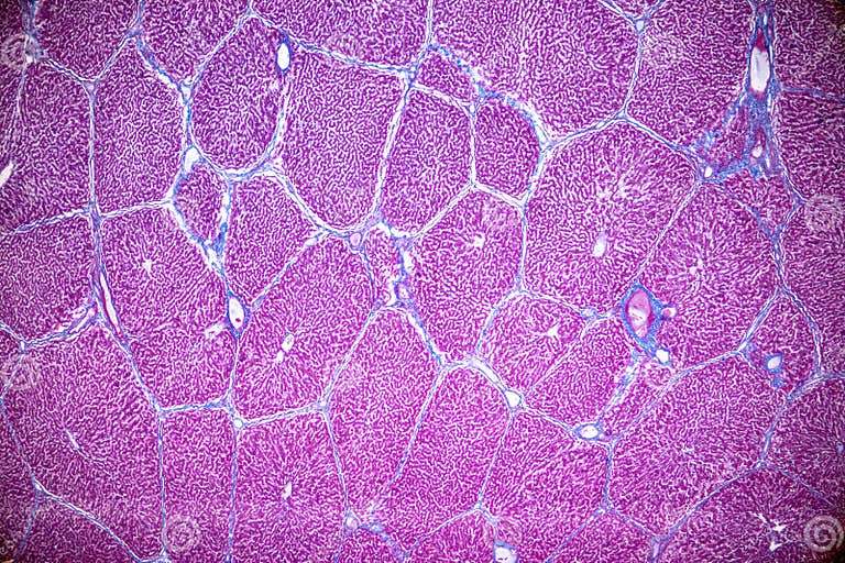 Tissue of Liver Under the Microscope for Education. Stock Image - Image ...
