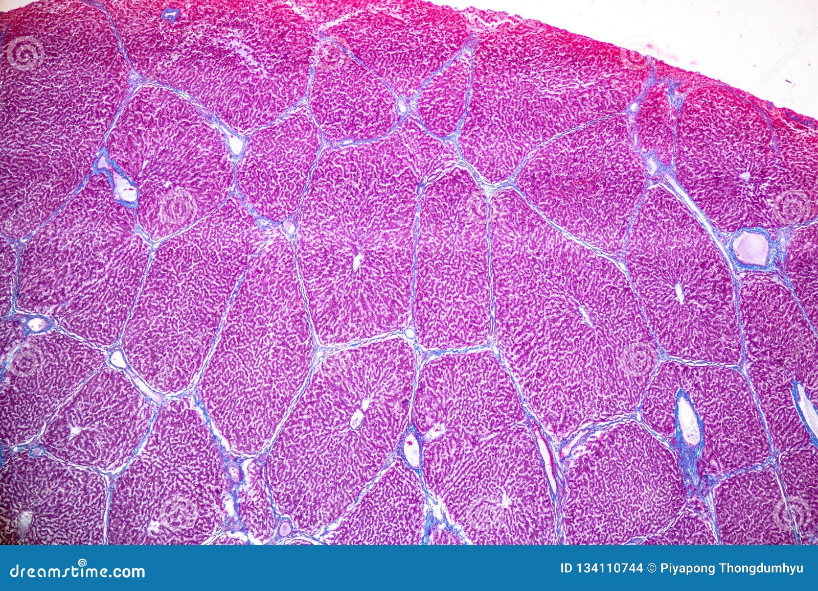 Tissue of Liver Under the Microscope for Education. Stock Photo - Image ...