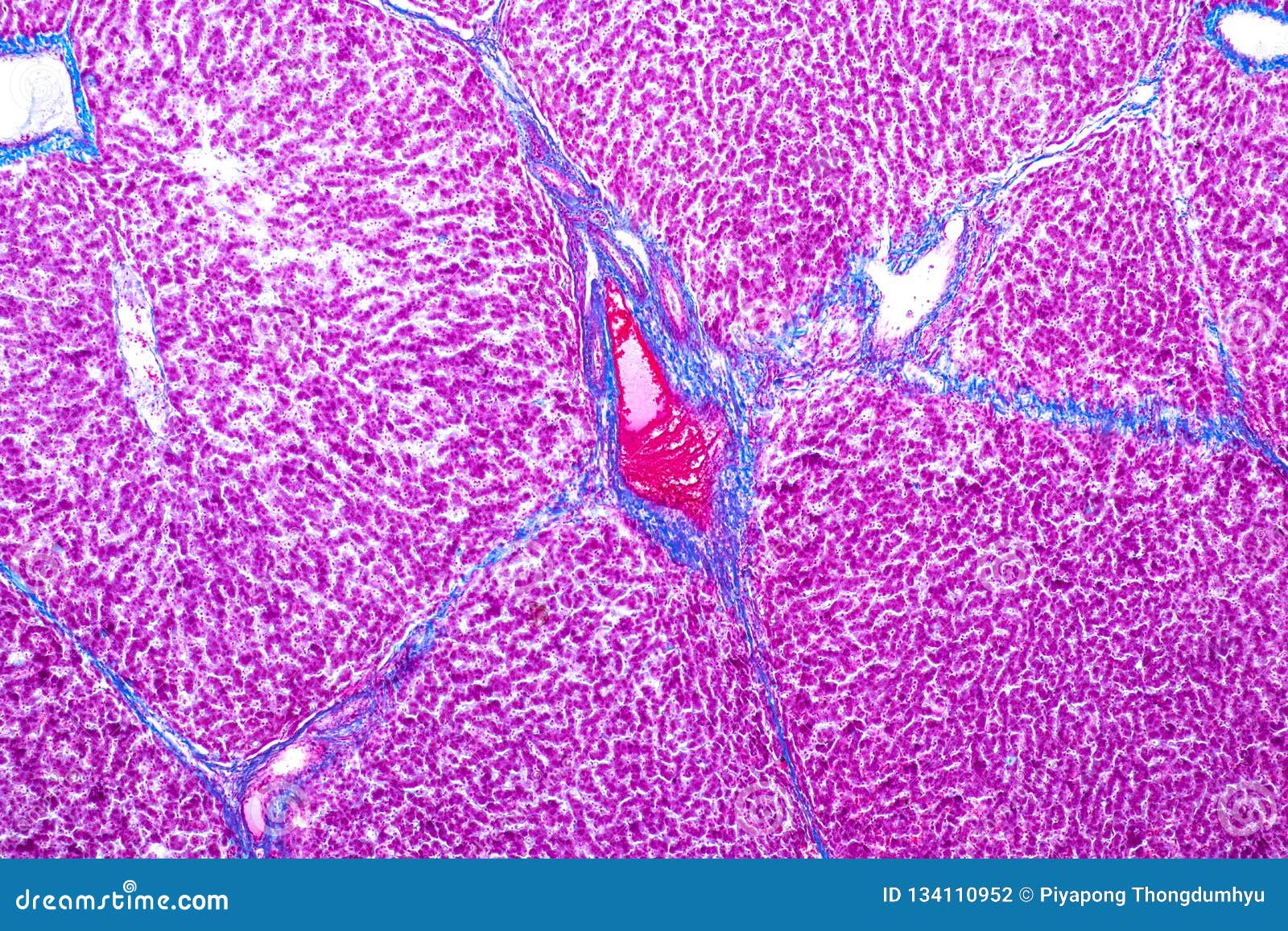 Tissue of Liver Under the Microscope for Education. Stock Photo - Image ...