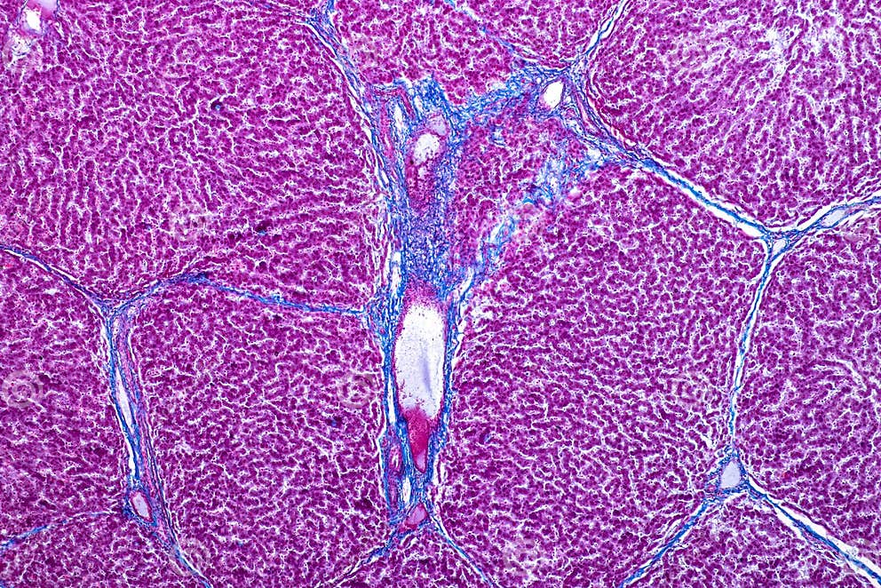 Tissue of Liver Under the Microscope for Education. Stock Image - Image ...