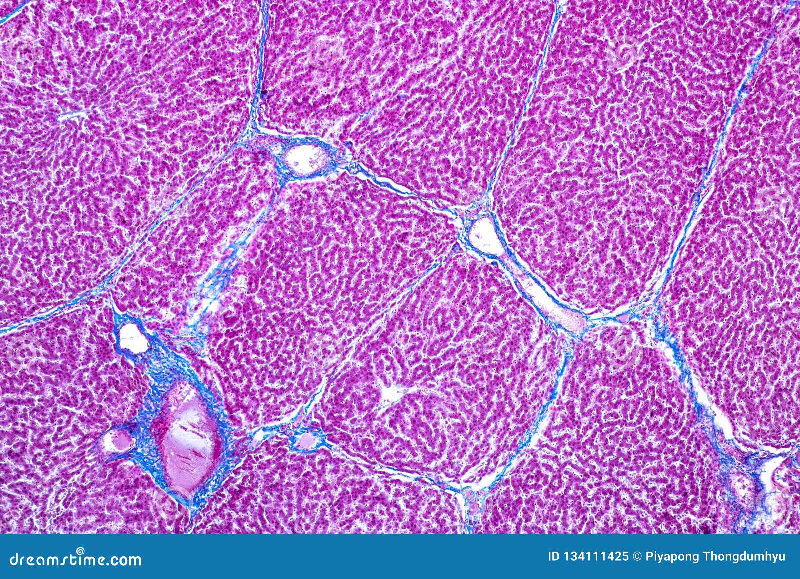 Tissue of Liver Under the Microscope for Education. Stock Image - Image ...