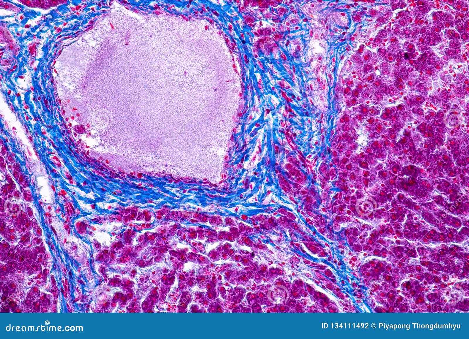 Tissue of Liver Under the Microscope for Education. Stock Photo - Image ...