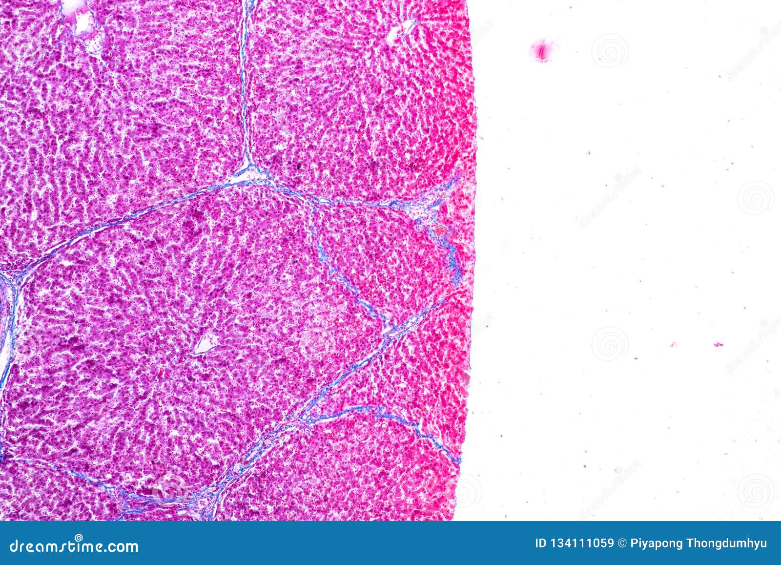 Tissue of Liver Under the Microscope for Education. Stock Image - Image ...