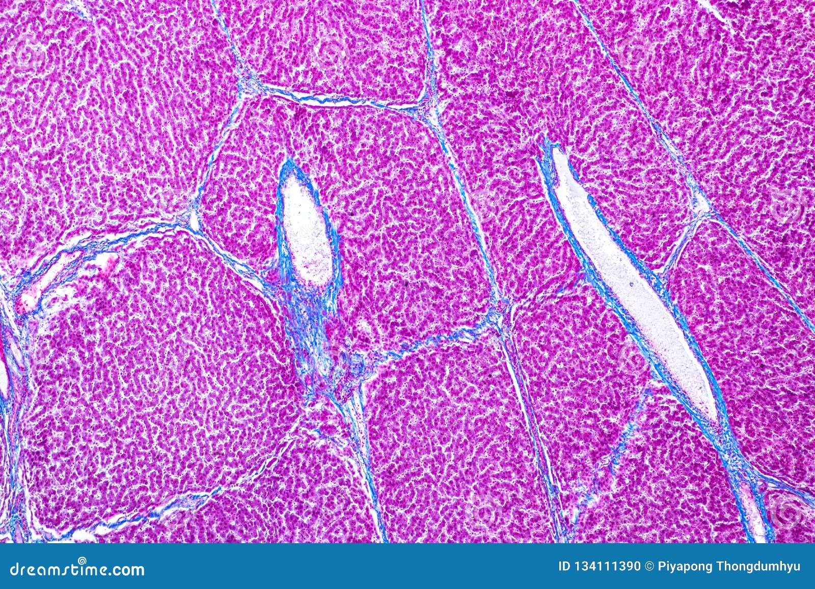 Tissue of Liver Under the Microscope for Education. Stock Photo - Image ...