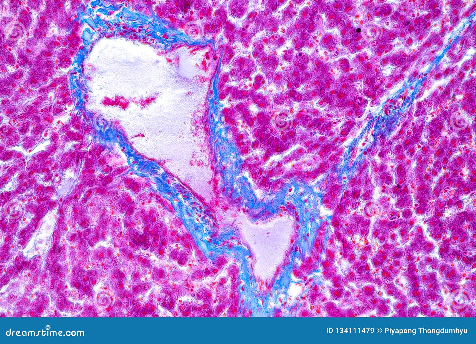 Tissue of Liver Under the Microscope for Education. Stock Image - Image ...