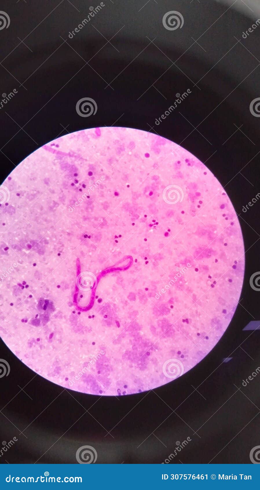 Tissue Nematodes :Asian Bloodworm Stock Image - Image of bloodwor ...
