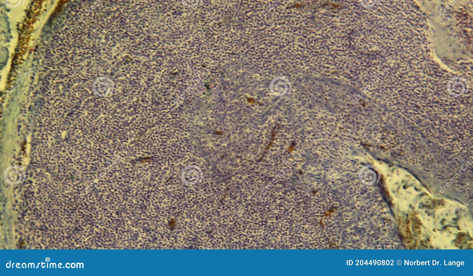 Tissue of the Palatine Tonsil Stock Footage - Video of research, nervus ...