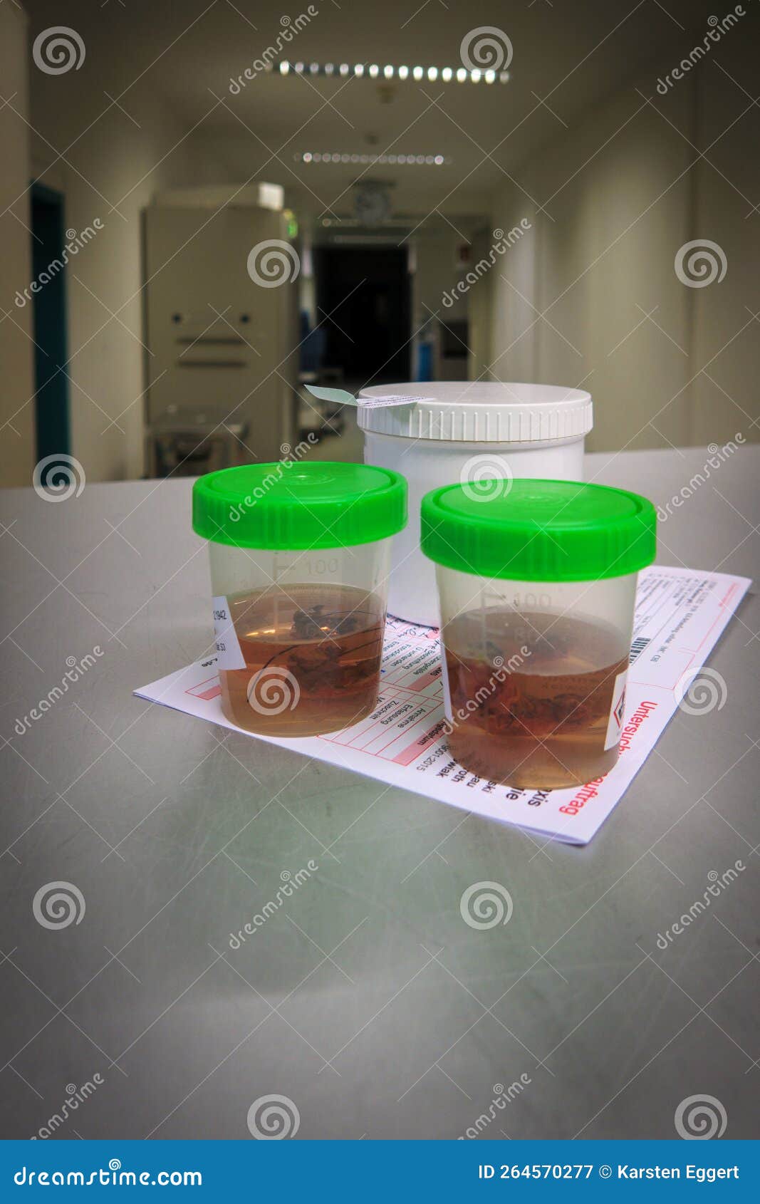 Tissue Samples are Placed in Formalin for Subsequent Examination by a ...
