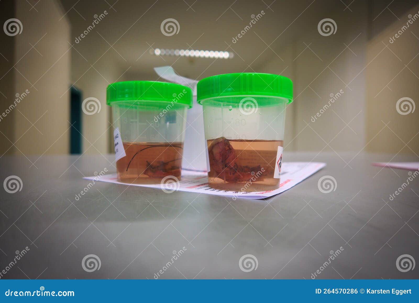 Tissue Samples are Placed in Formalin for Subsequent Examination by a ...