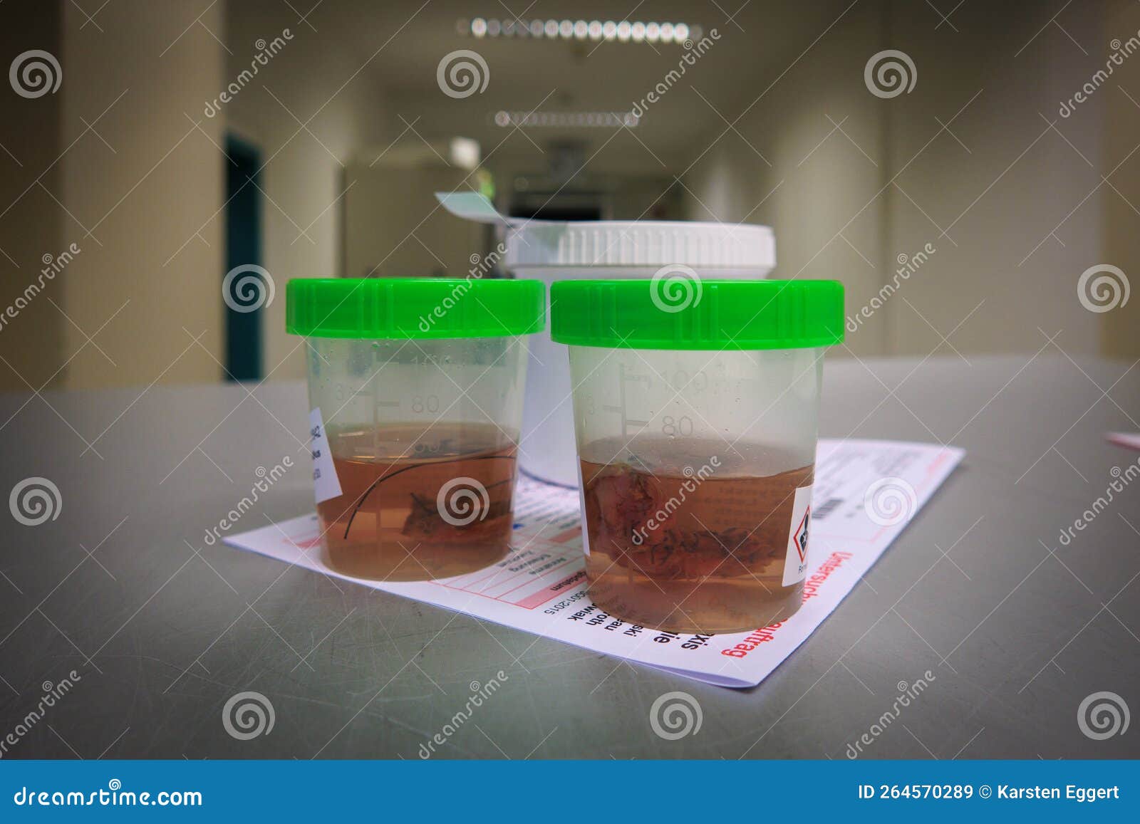 Tissue Samples are Placed in Formalin for Subsequent Examination by a ...