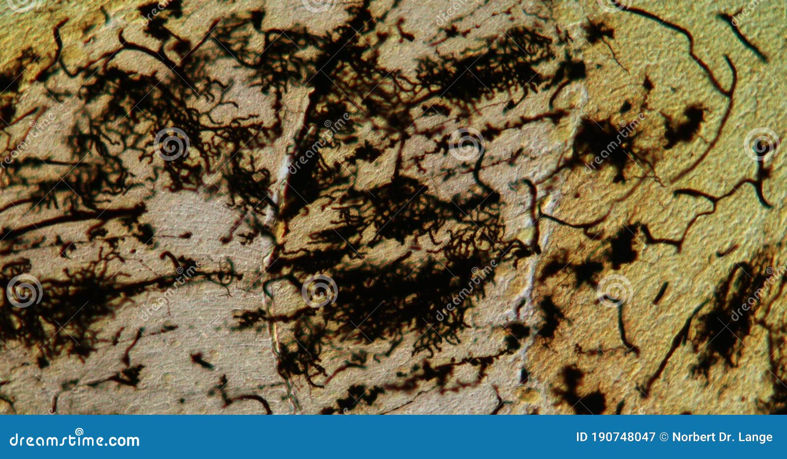 Tissue Sections of the Cerebral Cortex with Nerve Cells Stock Video ...